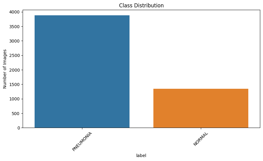 Case Study: Pneumonia Detection - Muhammad Zakkiy